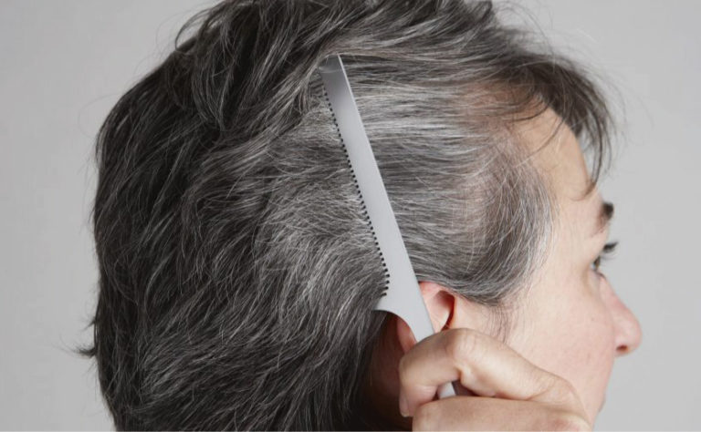 PREMATURE GREY HAIR: CAUSES AND PREVENTION