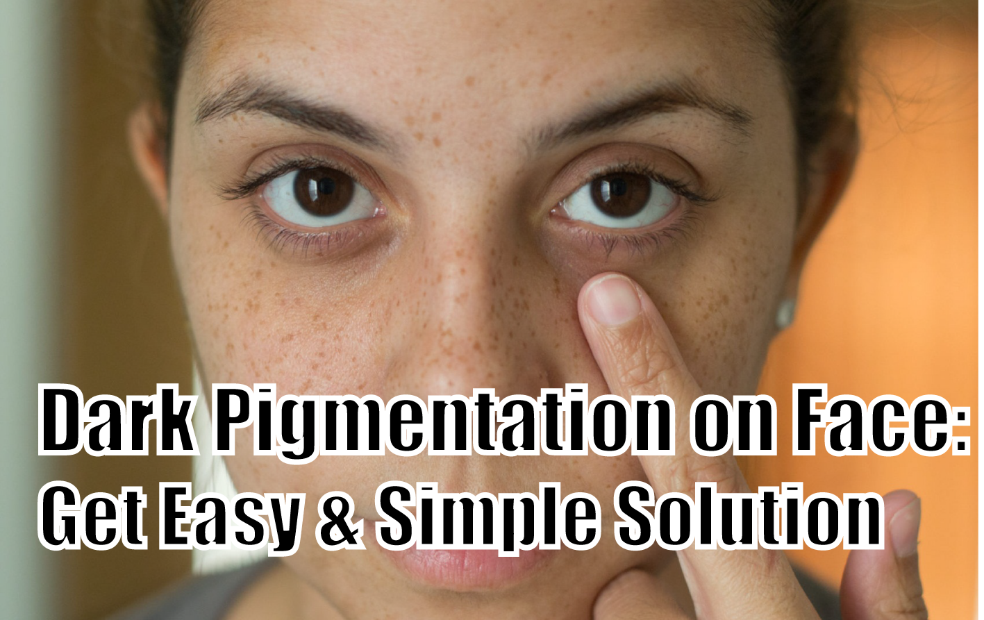 Dark Pigmentation on Face: Get 9 Simple Solution