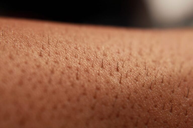 Can A Person Live Without Skin? Vital Role of Skin